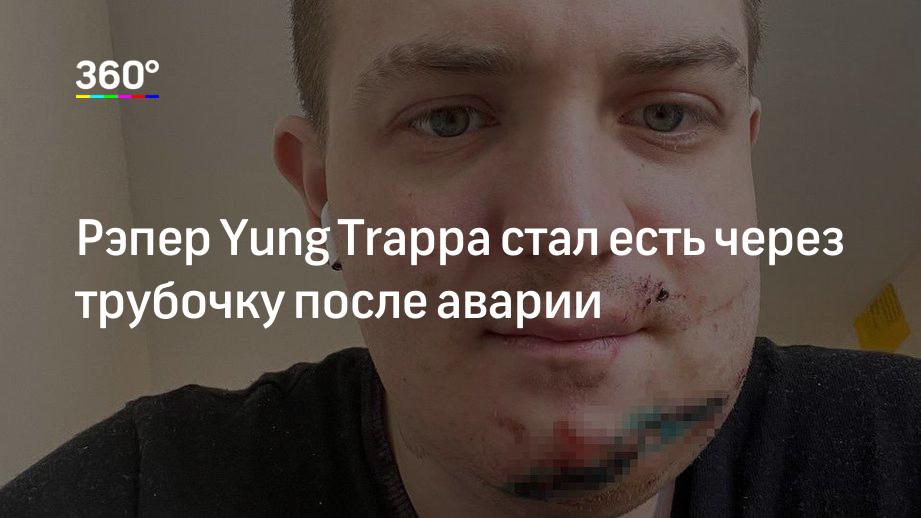Рэпер Yung Trappa стал есть через трубочку после аварии | 360.ru
